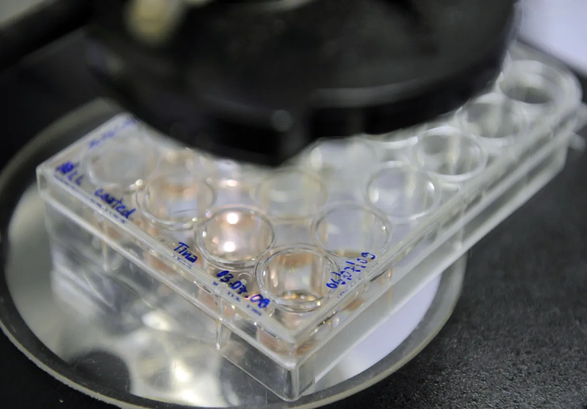Zadeva Biobanka: ministrstvo na JAZMP uvedlo sistemski nadzor