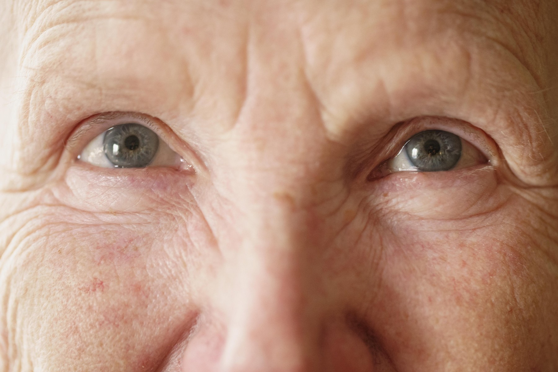 Kako so povezani pigmentni madeži, melanin in staranje kože? - N1