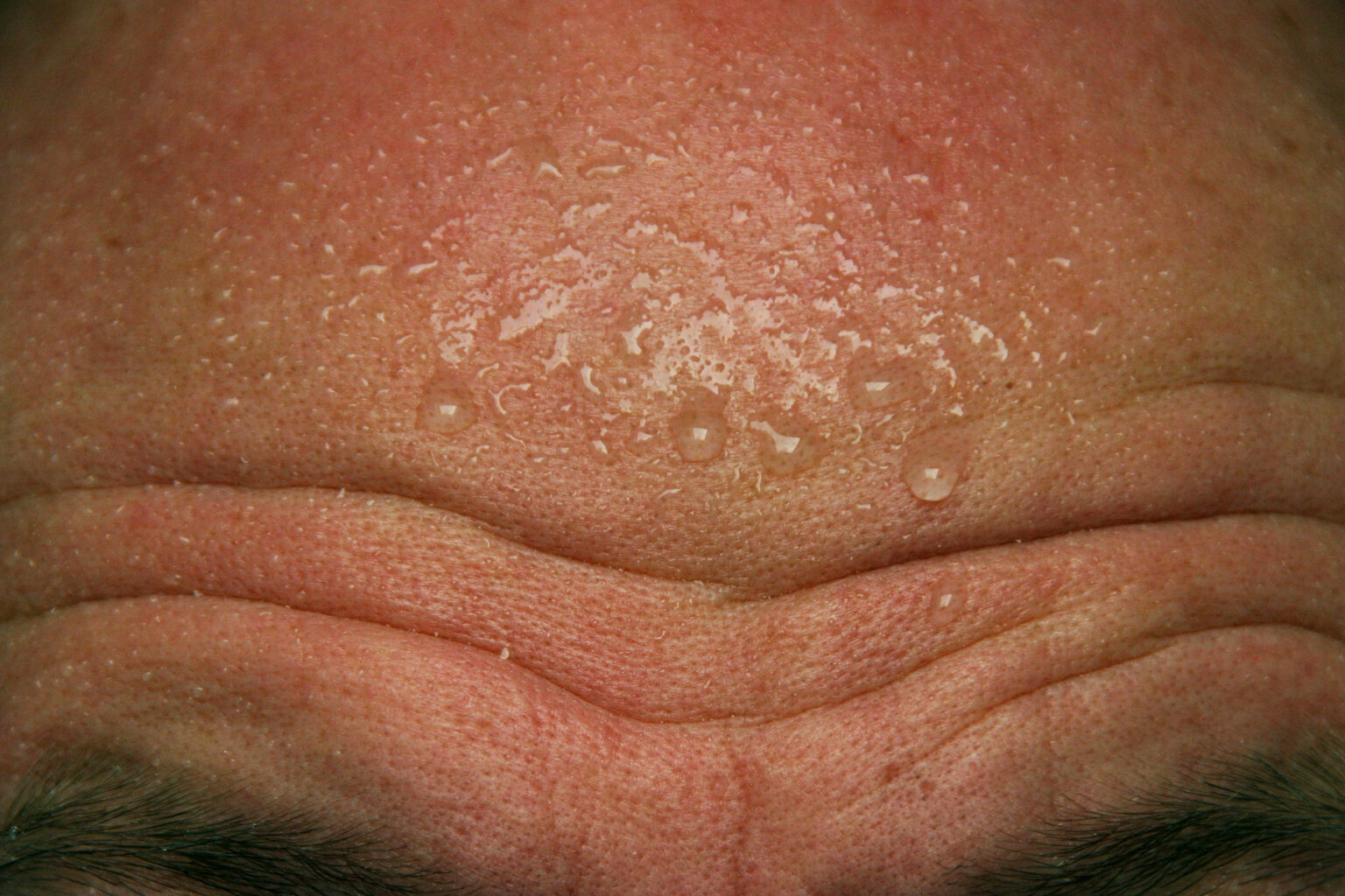 Visoke temperature: kako je za hlajenje poskrbljeno v bolnišnicah in ...