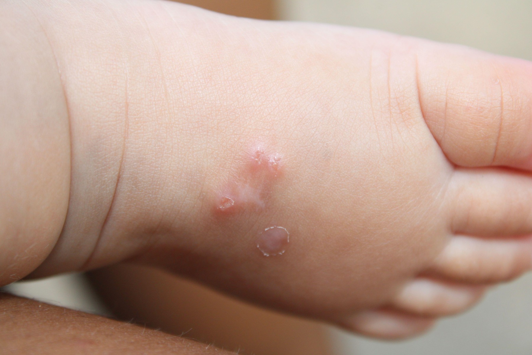 Garje v zaporu na Dobu: "Stanje je težko obvladljivo zaradi ...